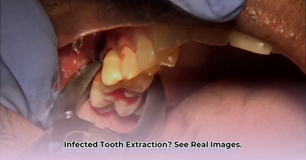 Is My Tooth Extraction Infected? Real Images and Expert Advice ...