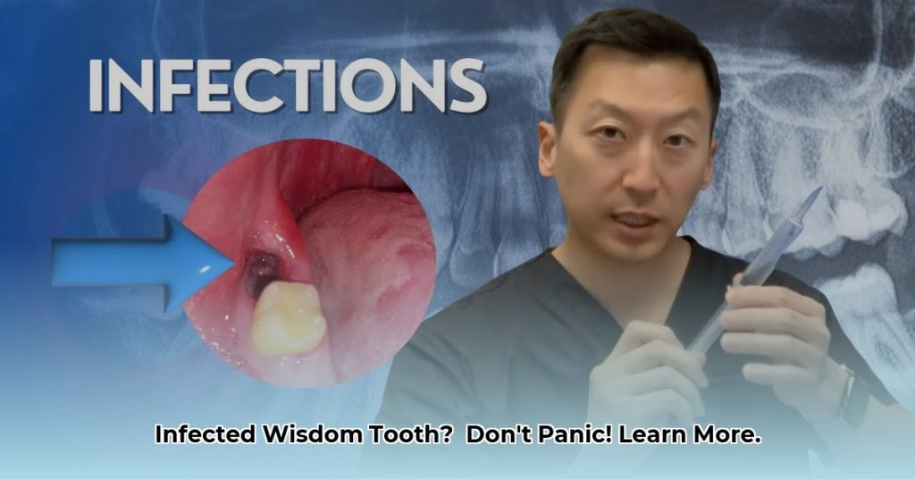 Infected Wisdom Tooth? Symptoms, Treatment, and Prevention - Lifestyle and Productivity