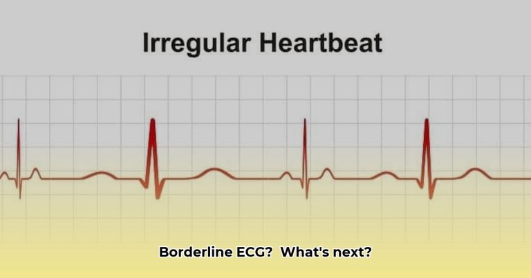 What Does a Borderline ECG Mean? Understanding Your Results - Lifestyle ...