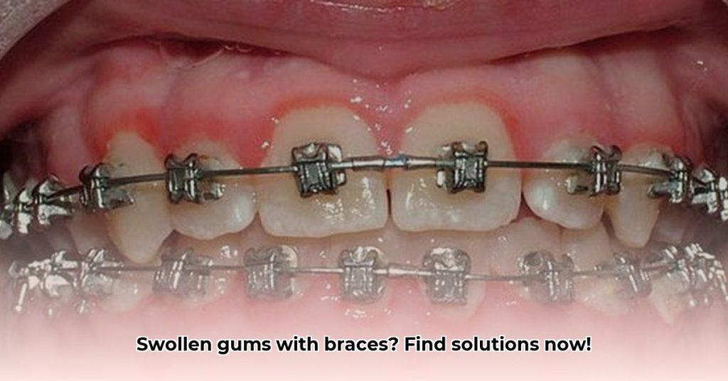 Braces and Swollen Gums: Causes, Treatment, and Prevention - Lifestyle ...