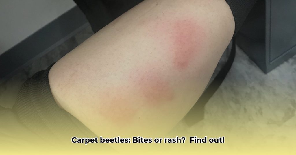 Do Carpet Beetles Bite? The Truth About Carpet Beetle Rash - Lifestyle ...