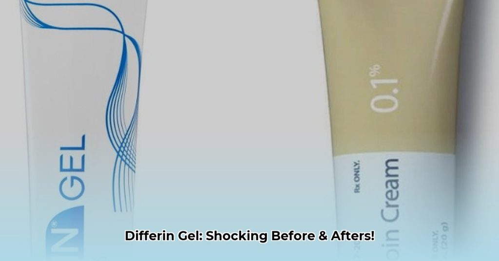 Differin Gel Before and After: Real Results and User Transformations ...