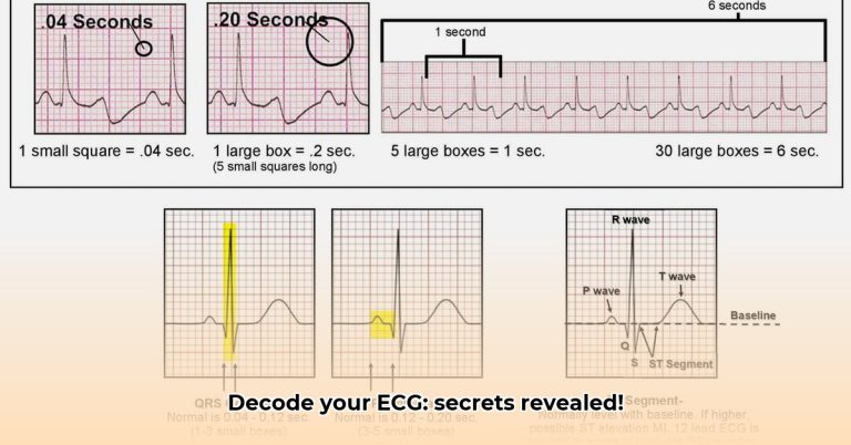 Understand Your ECG Report: A Simple Guide - Lifestyle and Productivity